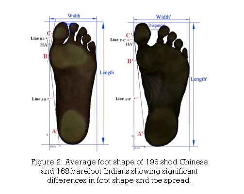 Foot dysfunction and cure part 1